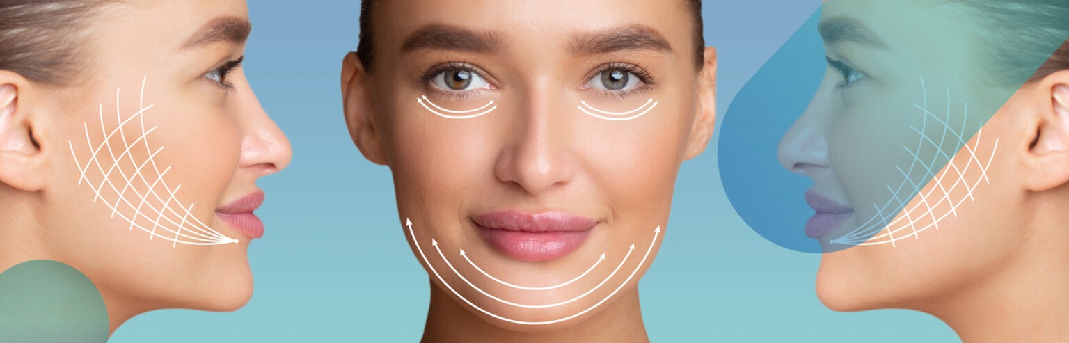 Fadenlifting - Ameri Derm